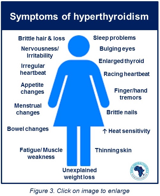 Hyperthyroidism In Nigeria Causes Symptoms Diagnosis And Treatment